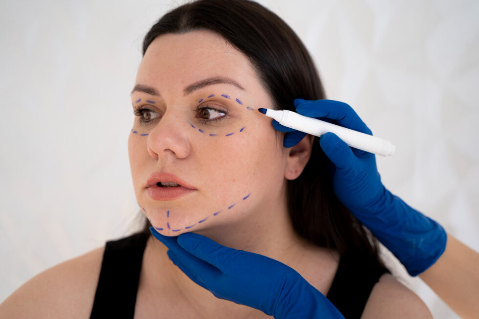 Thread Facelift in Mohali & Chandigarh | Skin & Cosmetic Clinic